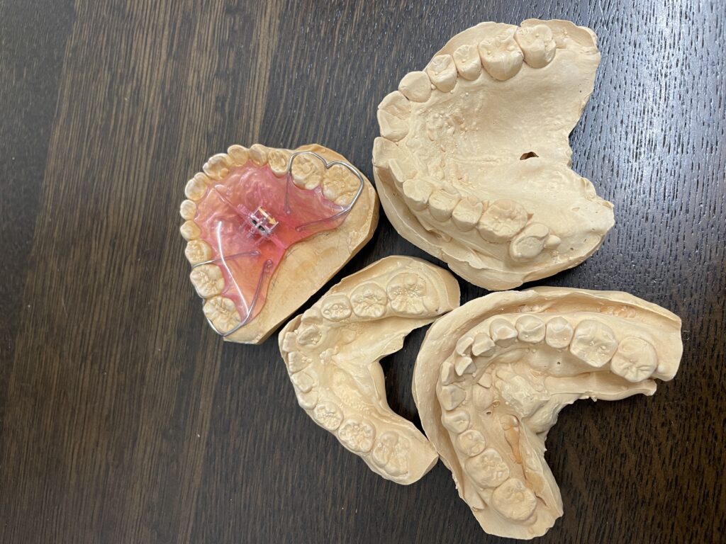 矯正 | 津市のふかだ歯科医院