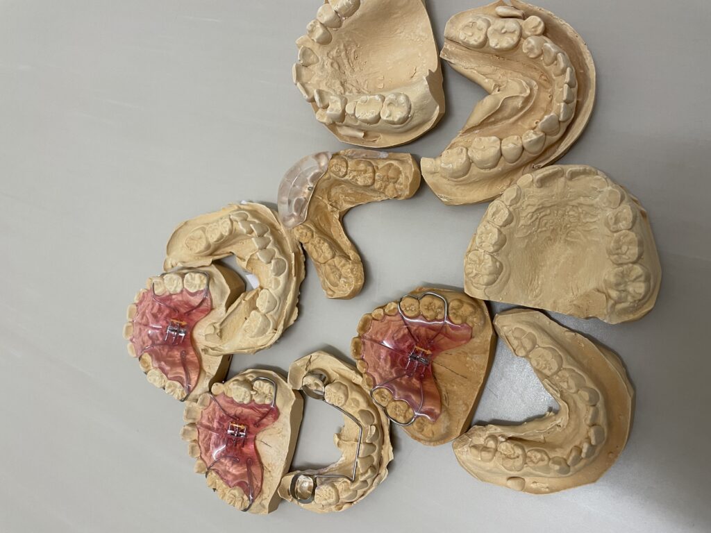 矯正 | 津市のふかだ歯科医院